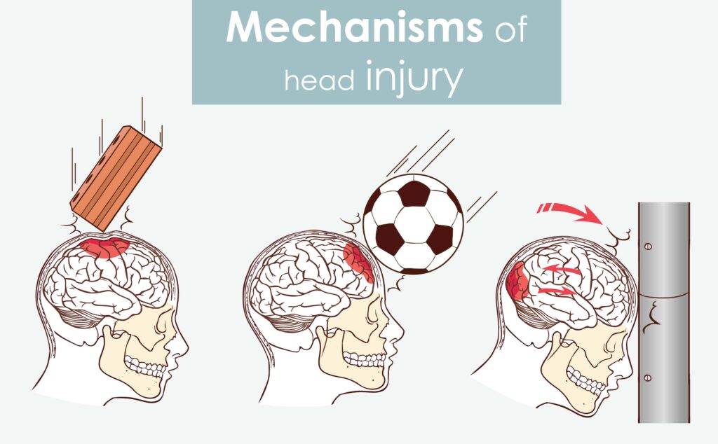 Neurology Insights: Understanding the Most Common Types and Causes of ...