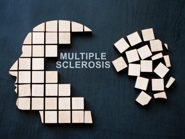 Multiple Sclerosis (MS): Exploring Treatment Options and New Approaches ...